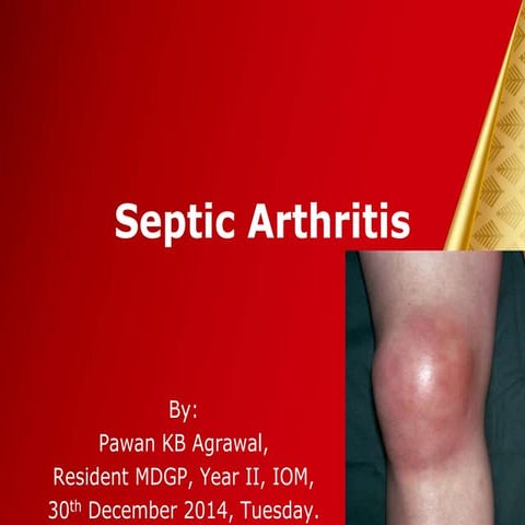 8. septic arthritis 30th dec 14 | PPTX