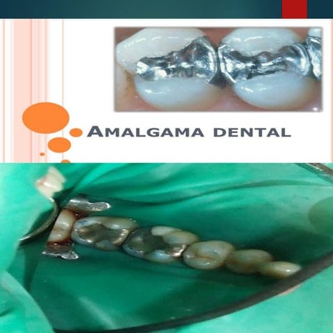 8. amalgama dental | PDF