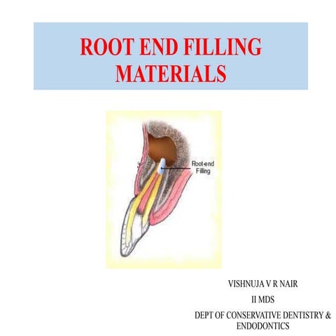 Retro grade filling | PPT