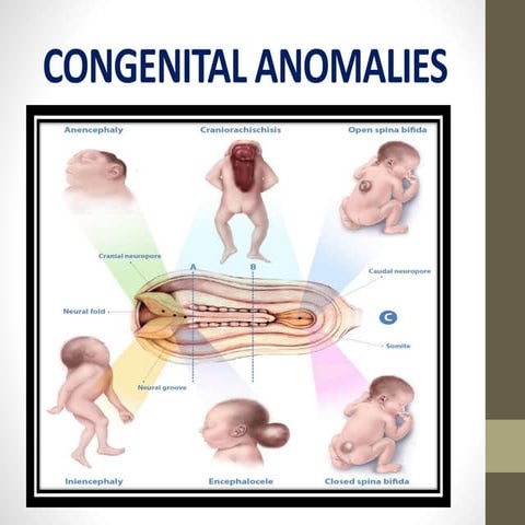 8 Congenital Anomalies Ppt Orthopedic Nursing Pptx