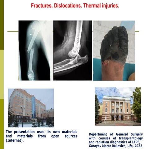 8. Fractures. Dislocations. Thermal injuries (lecture 8).pdf