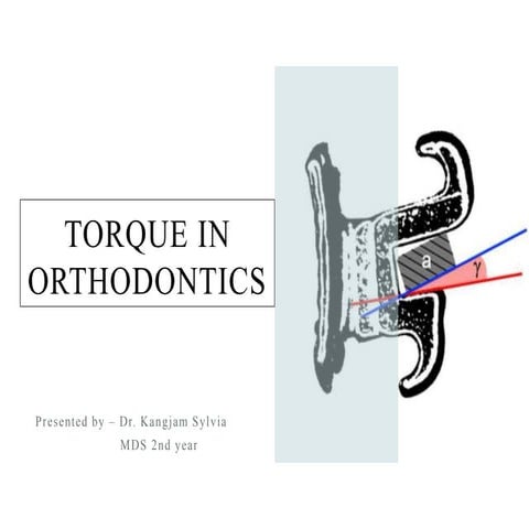 TORQUE IN ORTHODONTICS (short PPT) basic | PPTX