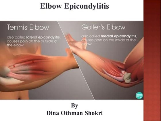 Golfer elbow.pptx