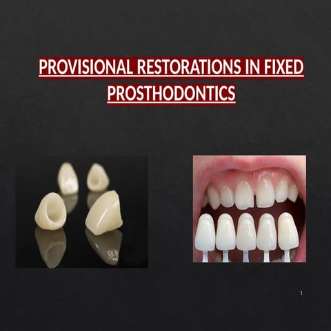8. PROVISIONAL RESTORATIONS IN FIXED PARTIAL DENTURE.pptx