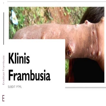 FRAMBUSIA.pptx