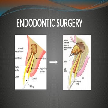 8-9- endodontic surgery - Endo perio relations1 and 2.pptx
