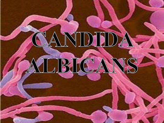 Candidiasis | PPTX