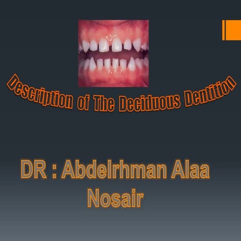 Deciduous teeth | PPTX