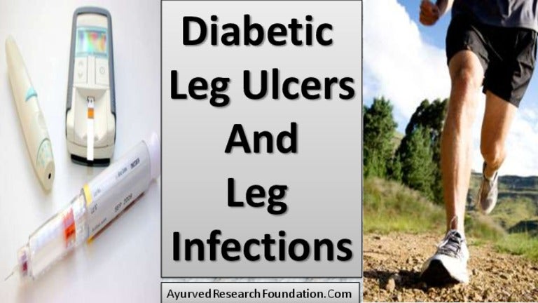Diabetic Leg Ulcers And Leg Infections