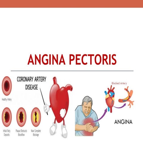 8- LH Angina pectoris 31-12 mod (1).pdfhjjjj | PDF