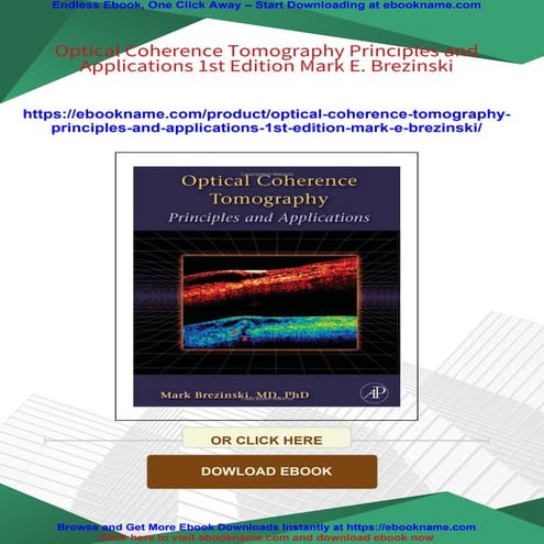 Optical Coherence Tomography Principles and Applications 1st Edition Mark E. Brezinski | PDF