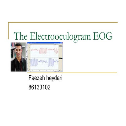 ELECTROOCULOGRAM (EOG) - Basics | PDF