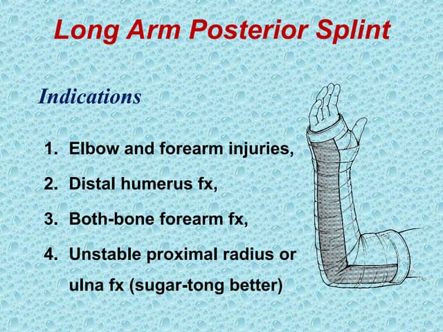 Cast & slab by dr. ahmed shedeed | PPTX