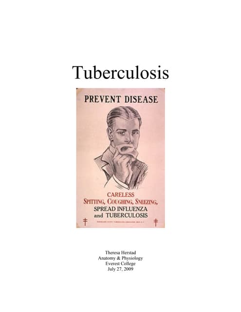 Tuberculosis presentation | PPT