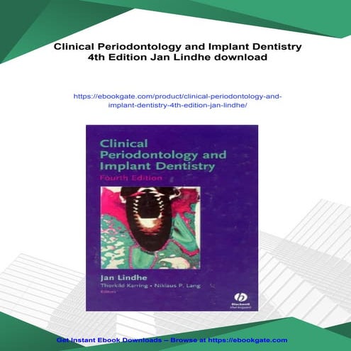 Clinical Periodontology and Implant Dentistry 4th Edition Jan Lindhe | PDF