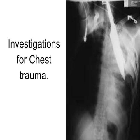 Investigations for Chest trauma | PPT