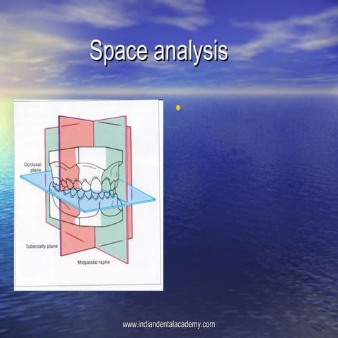 Space analysis | PPT | Dental Health | Diseases and Conditions