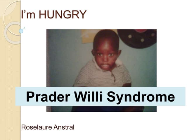 An over view of PRADER WILLI SYNDROME in children | PPTX