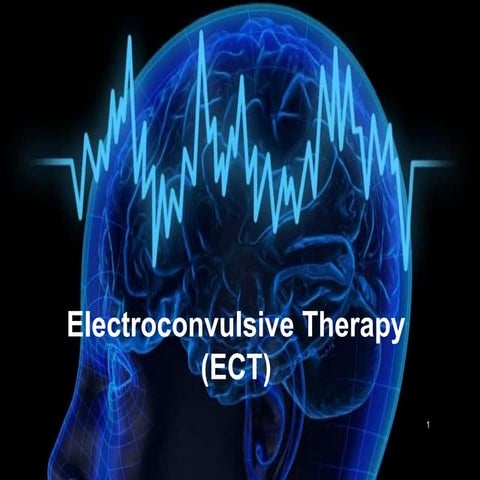 ECT Treatment Guide for Depression and Mental Illness | PPT