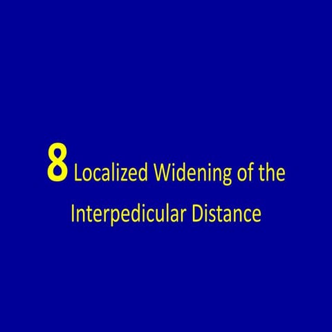 8 localized widening of the interpedicular distance | PPTX