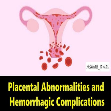 Postpartum Hemorrhage (PPH) and Ectopic Pregnancy | PPTX