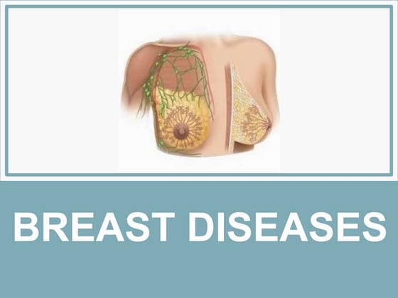 Tumors of the breast | PPTX