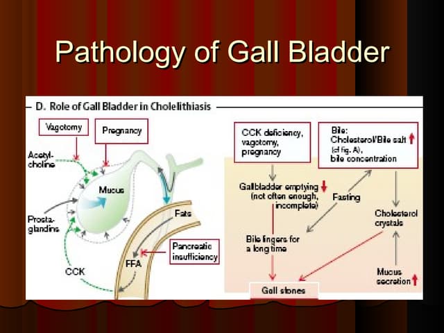 Pathophysiology of Cholecystitis and cholelithiasis | PDF