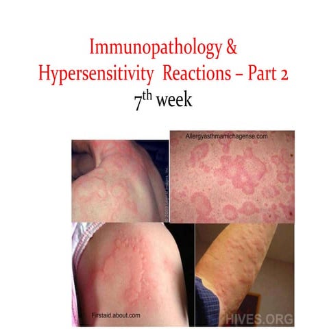 HIV(Human Immunodifficiency Viruses) A-LEVEL Biology PowerPoint | PPTX