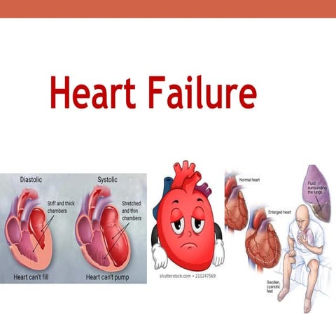 HEART FAILURE MANAGEMENT.pptx management | PPTX