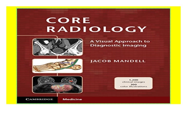 Core Radiology: A Visual Approach to Diagnostic Imaging 2018 ebook$@@