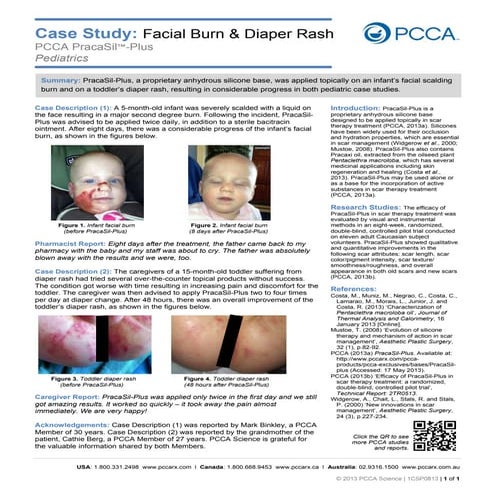 Case Study Infant Burn & Diaper Rash | PDF