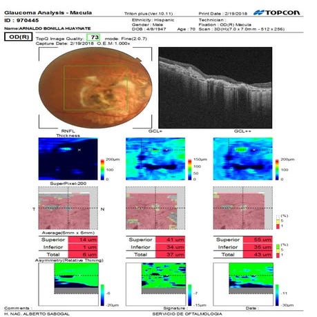 970445 20180219 115156_oct_report_r_001 | PDF