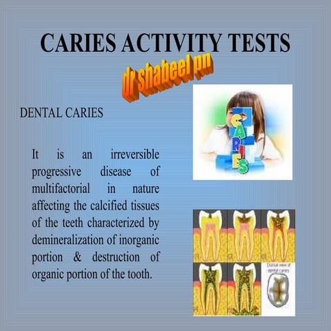 Caries Activity test - saliva - dental ... | PPT