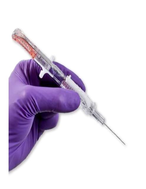 IVC Filter Pic 1 | DOCX