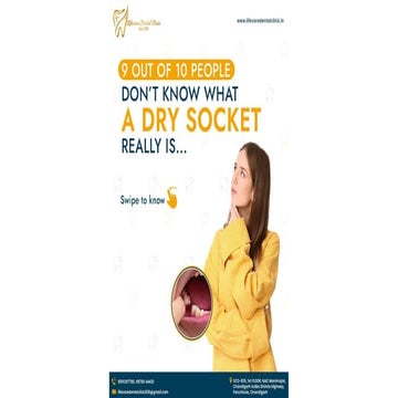 9 Out of 10 People Don't Know What A Dry Socket Really Is | PPT