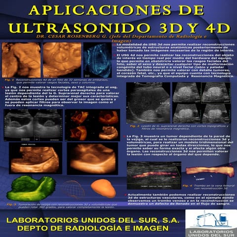 Utilidades del Ultrasonido 4D | PPT