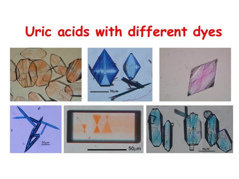 Uric Acids With Different Dyes
