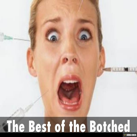 The Best of the Botched | PPT