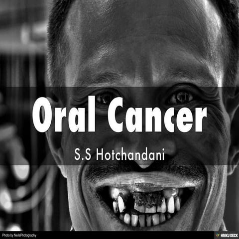 Oral Cancer | PDF