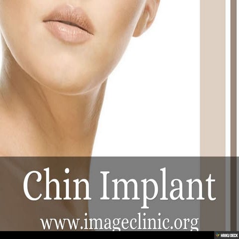 Chin Implant | PDF