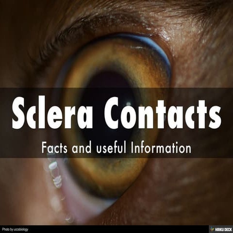 Sclera Contacts | PDF