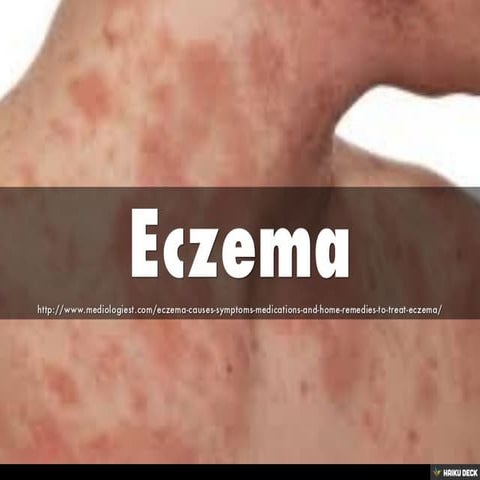 Eczema | PDF