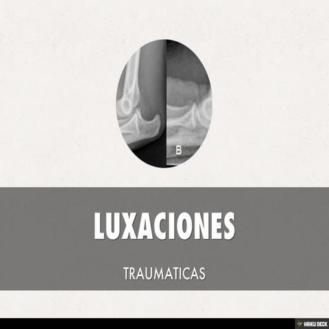 LUXACIONES | PDF