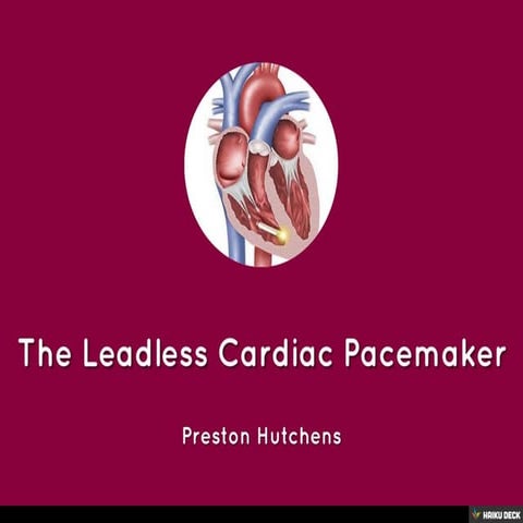 The Leadless Cardiac Pacemaker | PDF