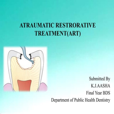 ATRAUMATIC RESTORATIVE TREATMENT (ART) | PPTX
