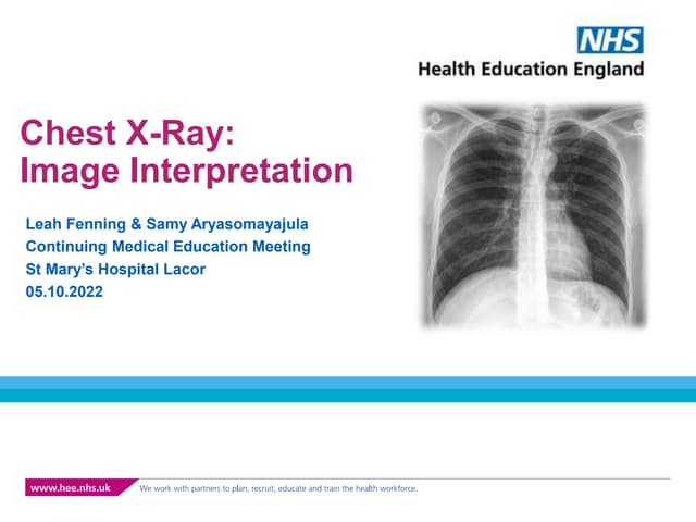 ABCDE CXR Final Version.pptx ABCDE CXR Final Version.pptx