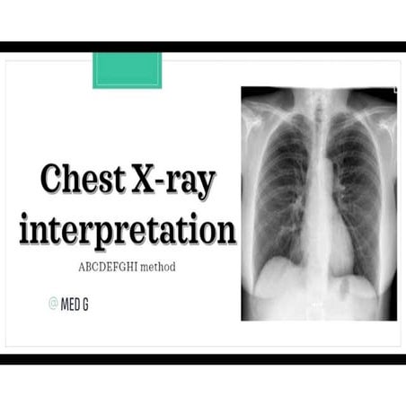 ABCDEFGH approach-- for chest X-Ray.pptx
