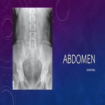 Surface Anatomy of the abdominal viscera and abdominal regions. | PPTX