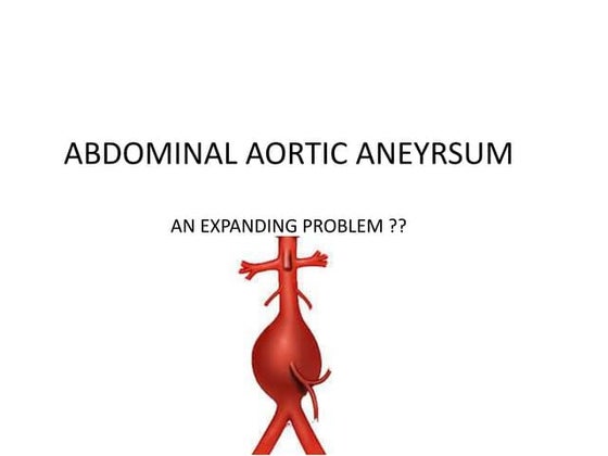 Abdominal Aortic Aneurysm | PPT | Digestive Disorders | Diseases and Conditions