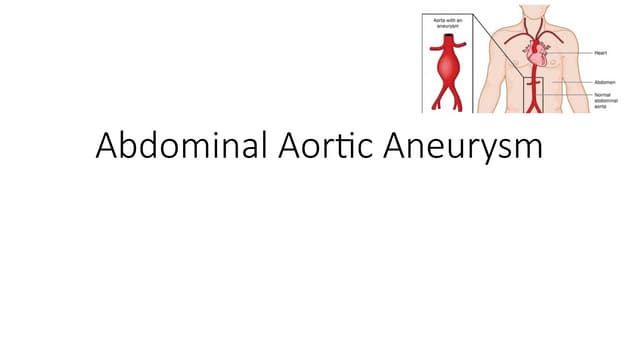Abdominal Aortic Aneurysm | PPT
